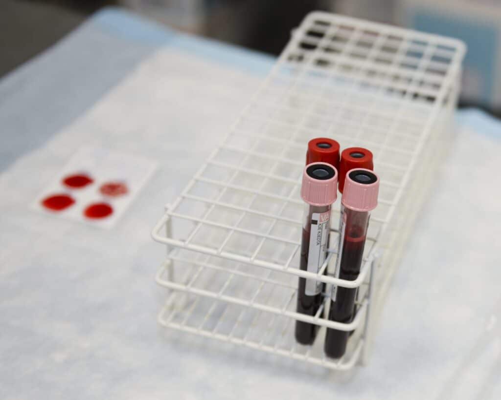 Is Blood Work Really Necessary? | Grand Valley Animal Hospital